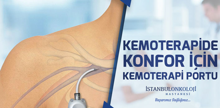 Kemoterapi 'de Konfor için Kemoterapi Portu